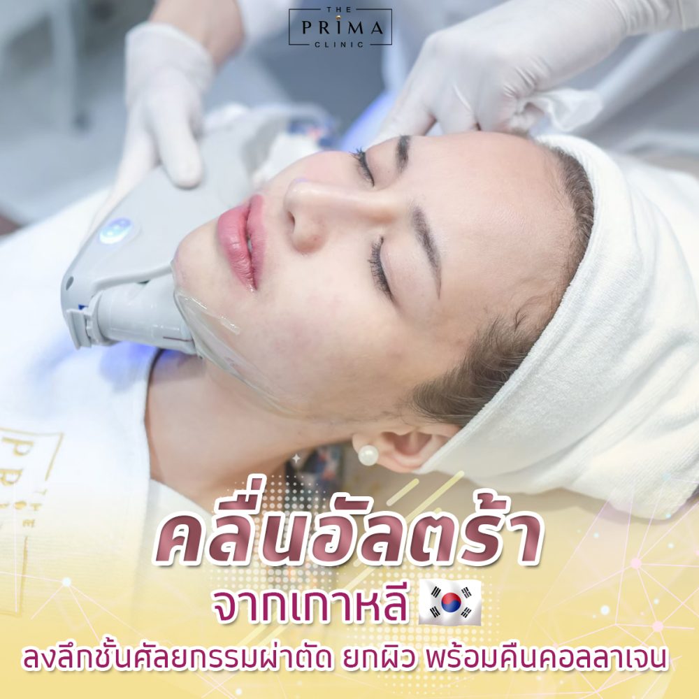 HIFU ไฮฟูชลบุรี ยังต้องแพ้ Prima Lift by Ultraformer III