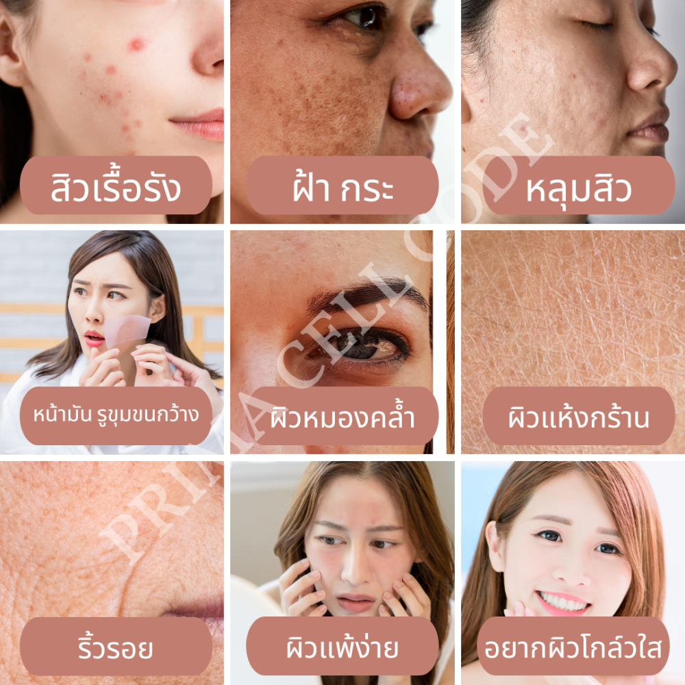 Prima Cell Code ฝังอาหารผิวในระดับเซลล์ | เดอะ พรีม่า คลินิก