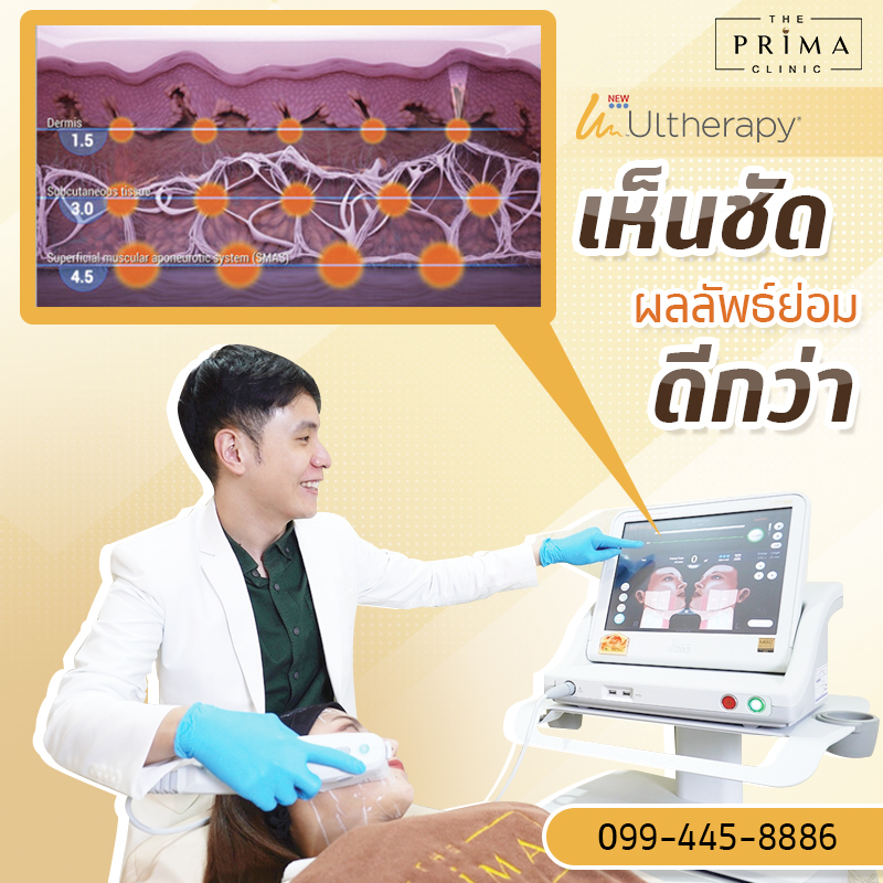 Ulthera เครื่องแท้ เครื่องปลอม เช็คยังไง | The Prima Clinic