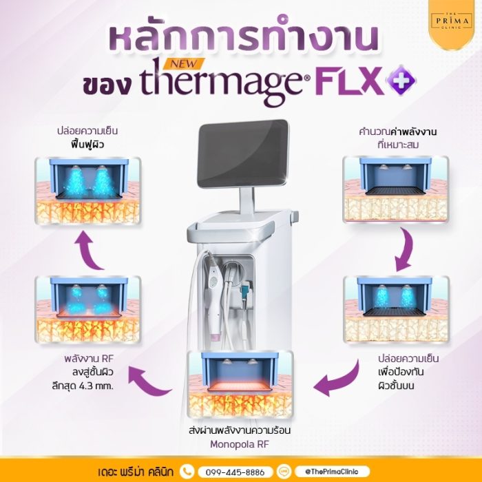 Thermage FLX vs Thermage CPT | เทอมาจ FLX ดีกว่า CPT อย่างไร