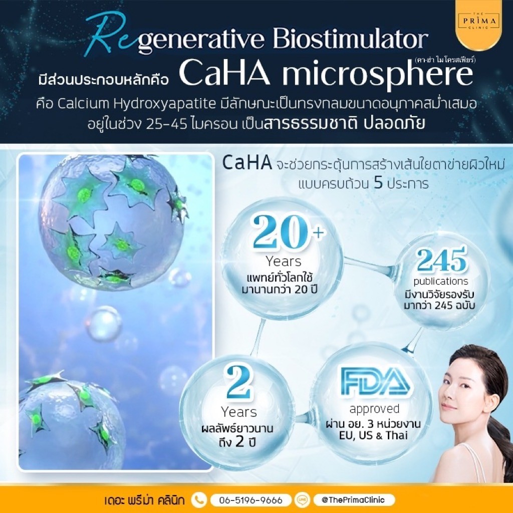 CaHA Microsphere คาฮ่า ไมโครสเฟียร์ | The Prima Clinic เดอะ พรีม่า ...